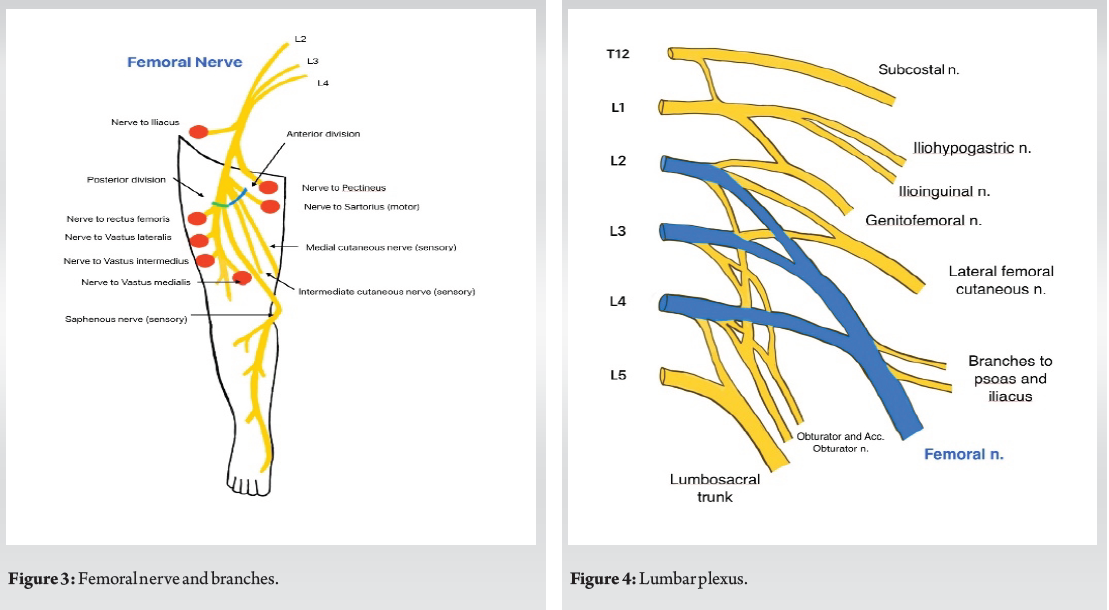 Femoral Nerve injury from slip and fall: A novel presentation of ...