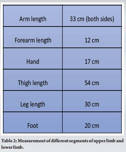 Neglected Bilateral Clubfoot Clubhand Deformity | Journal of ...