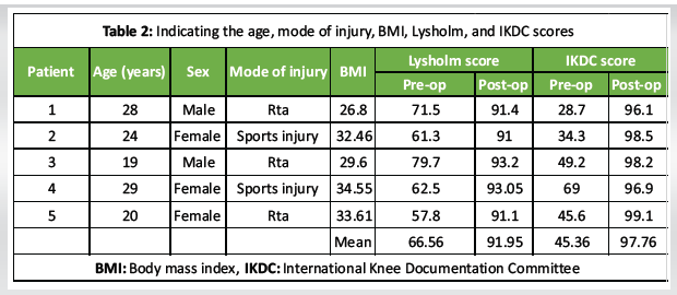 Simultaneous ACL Reconstruction and MCL Reconstruction in Patients with ...