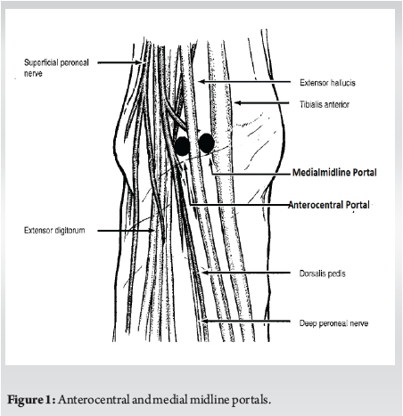 Cadaveric Study on the Safety of Medial versus Anterocentral Portals in ...