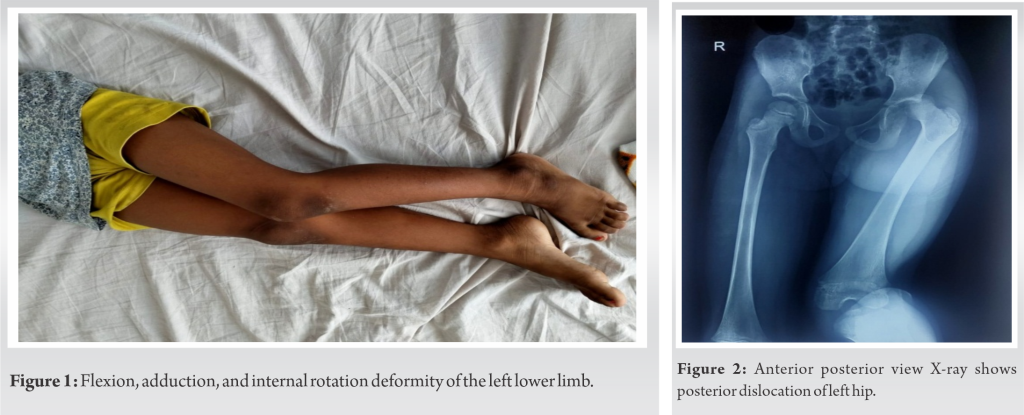 Uncommon Yet Noteworthy: A Clear and Comprehensive Case Report on ...