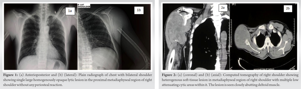 Fig 1 2 | Journal of Orthopaedic Case Reports