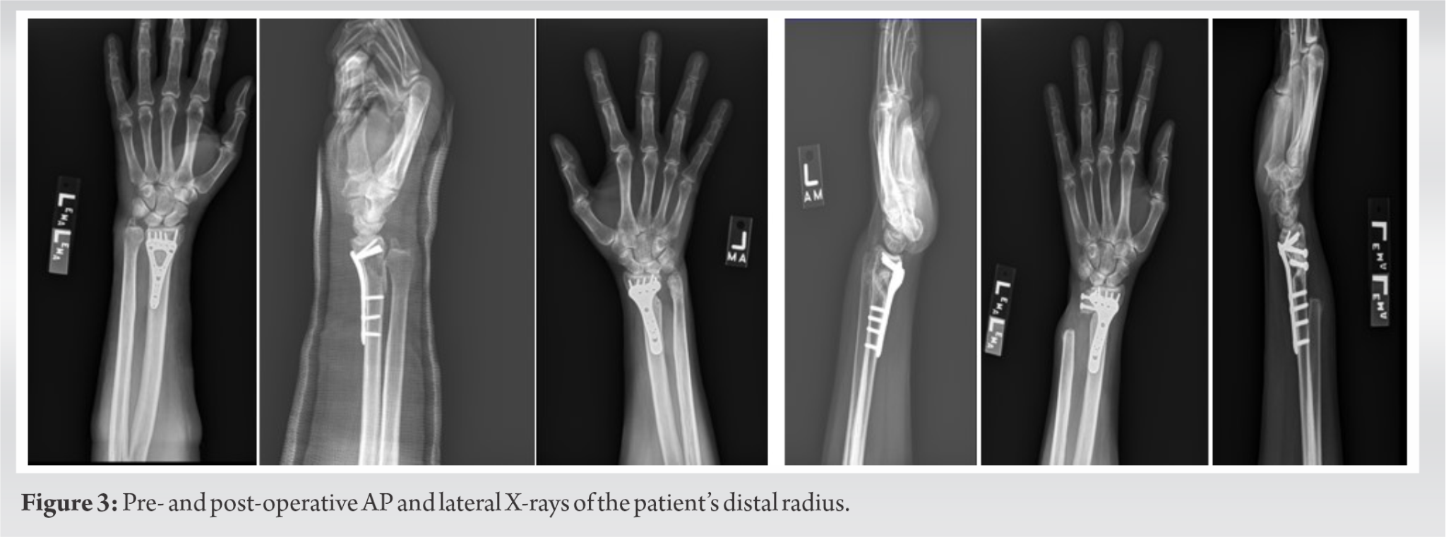 Revisiting the Importance of the Pre-Operative Assessment – A Case ...