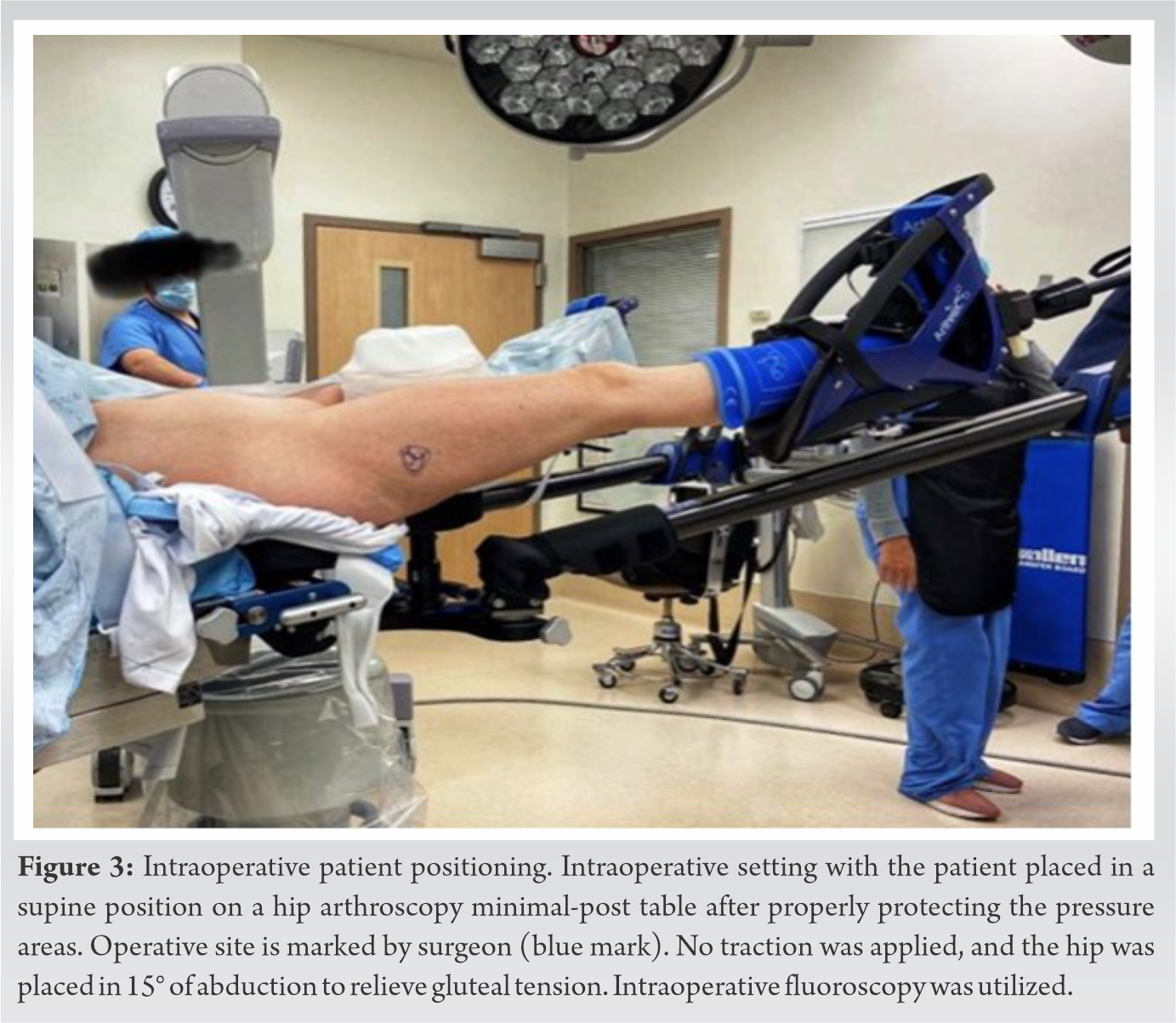 Endoscopic Repair of Hip Abductor Tendon Tears: A Case Report | Journal ...