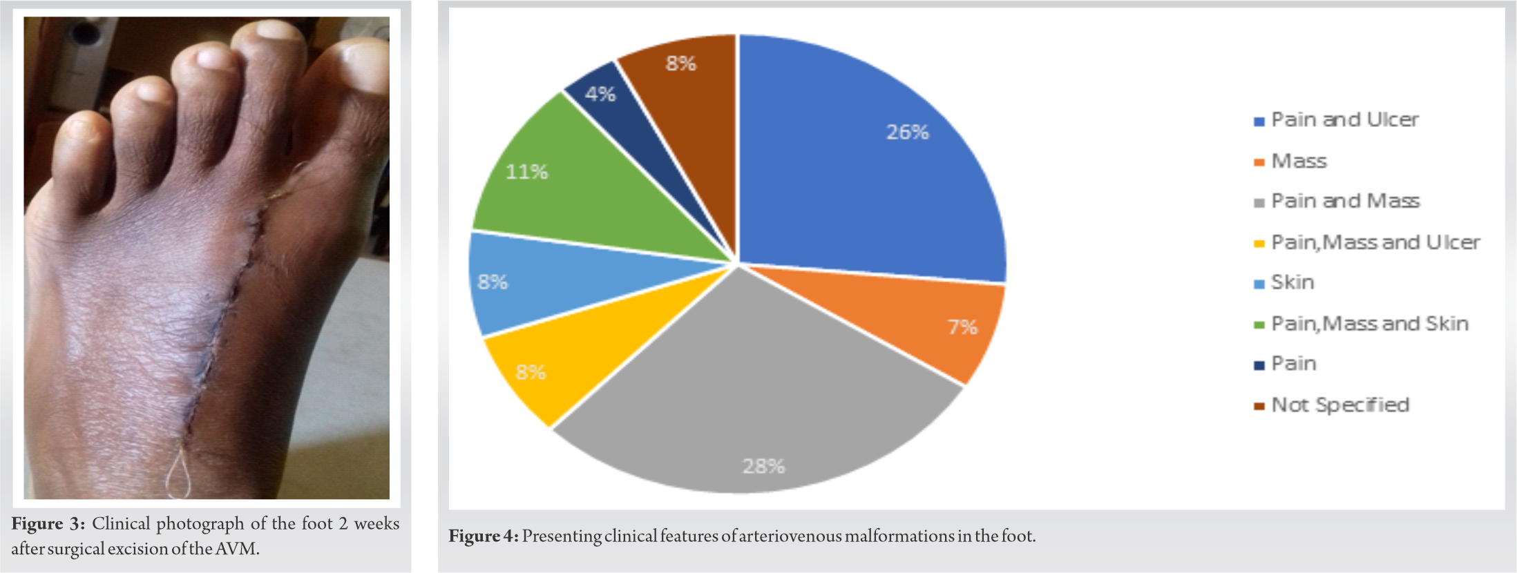 Fig 3 4 | Journal of Orthopaedic Case Reports