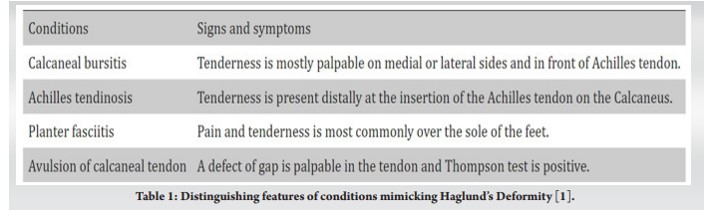Heel Pain Management in Haglund’s Deformity Targeting Sural Nerve ...